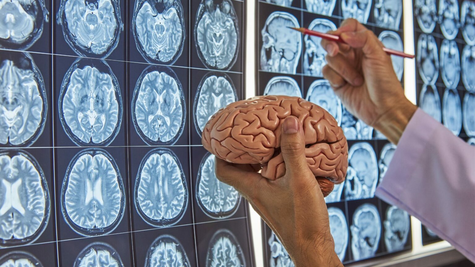 What is Adaptive Deep Brain Stimulation and How it Helps Parkinson’s ...